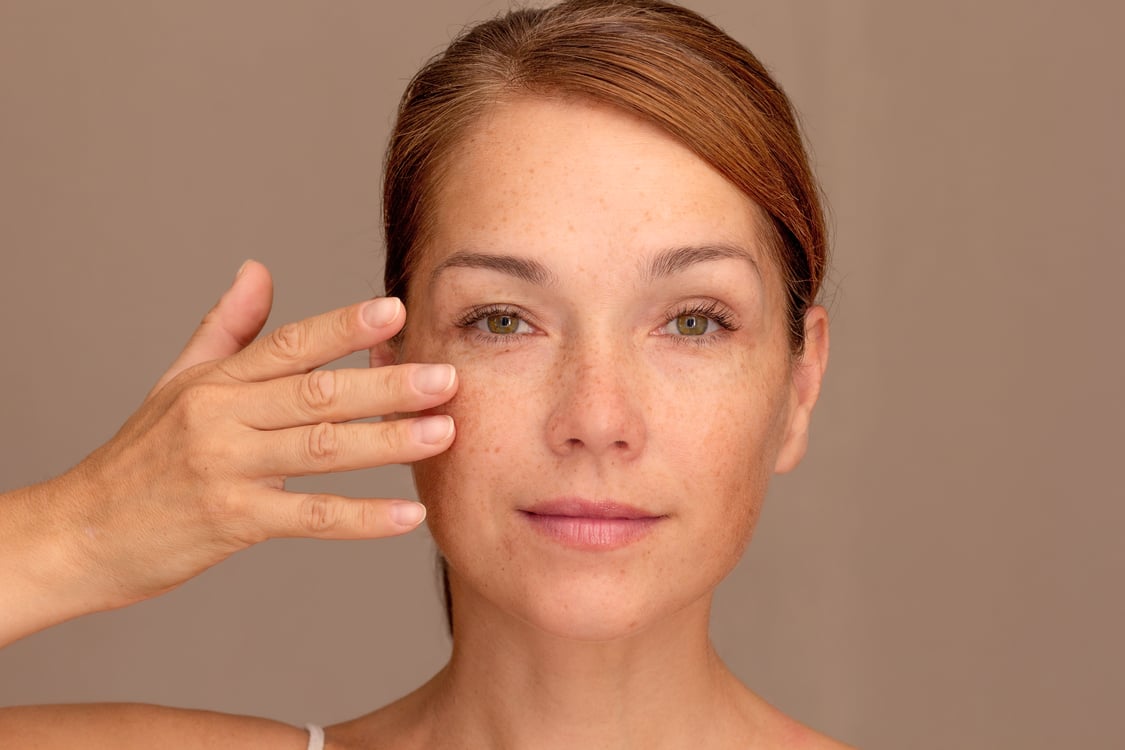 Neovie - Skin Laxity