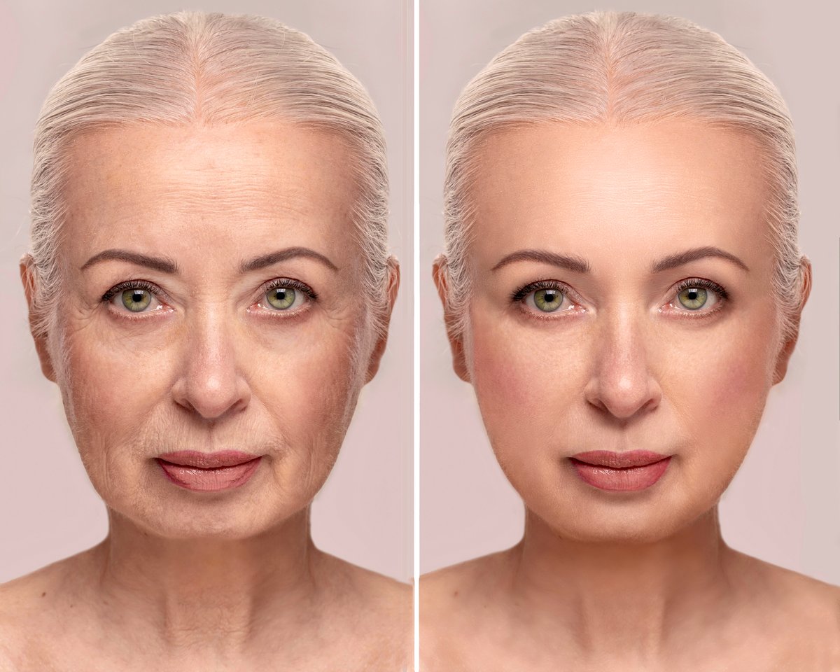 Neovie - Mesotherapy Technologies